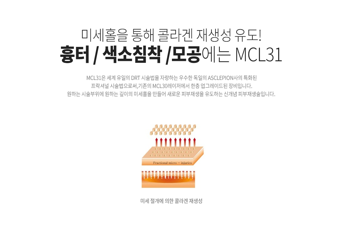 MCL31 - 미큐의원